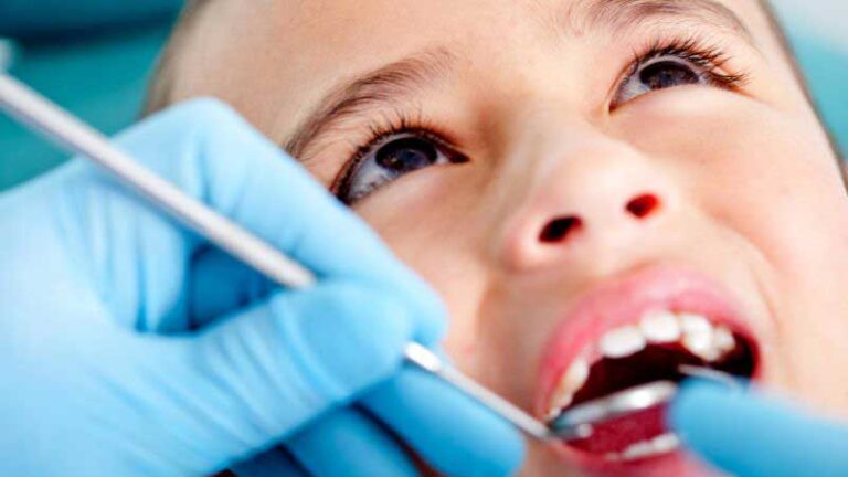 The Importance of Addressing Baby Tooth Cavities